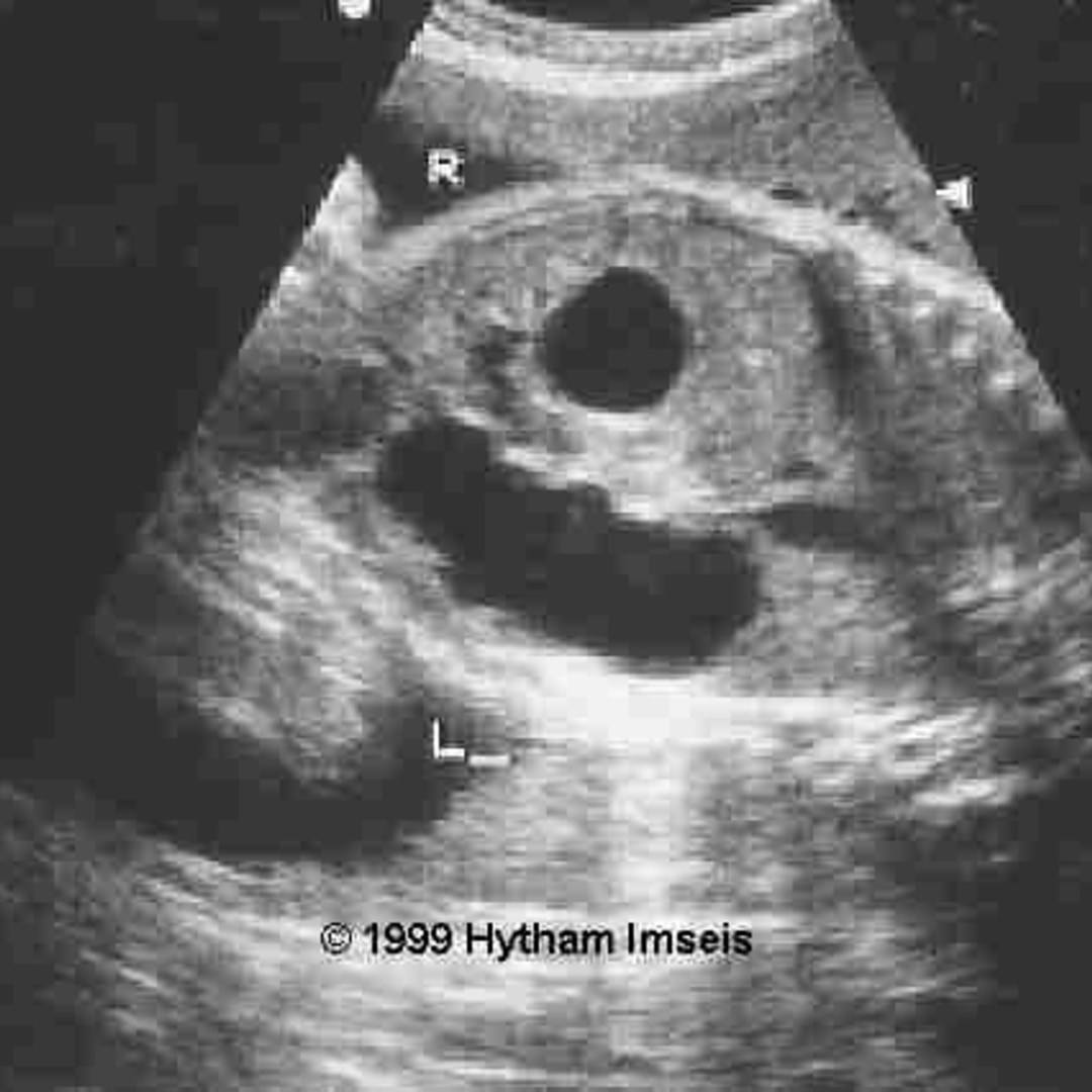 Case of the Week # 4