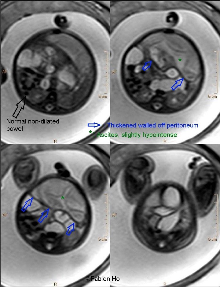 Case of the week #536