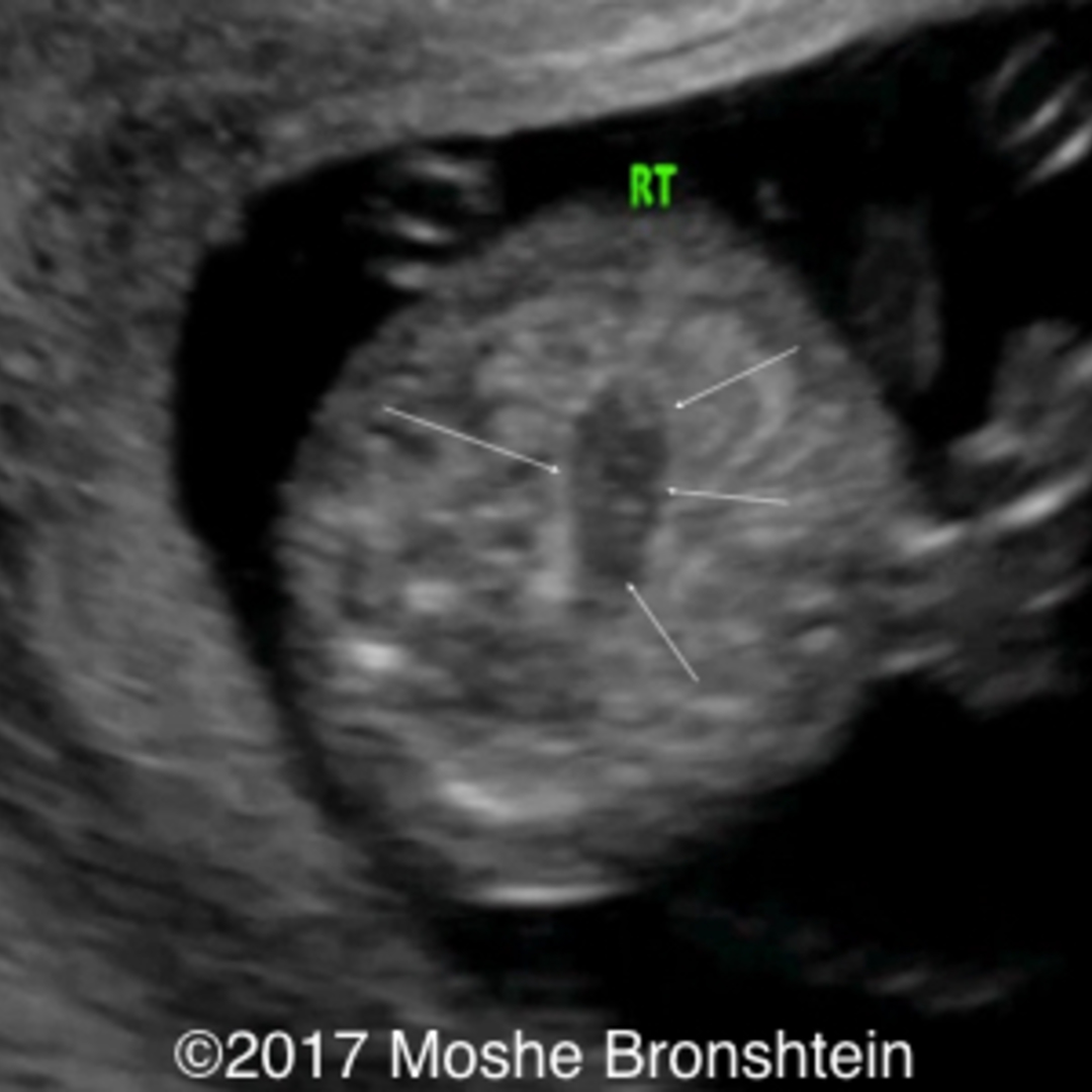 Case of the Week # 450