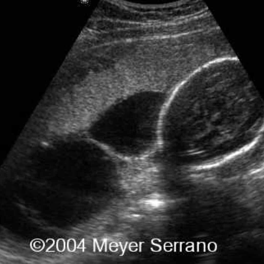 📃 Limb-body-wall complex