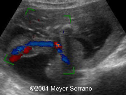 📃 Limb-body-wall complex