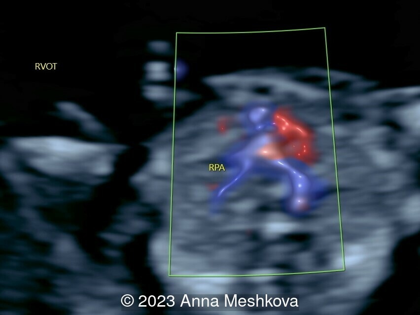 Case of the Week #600