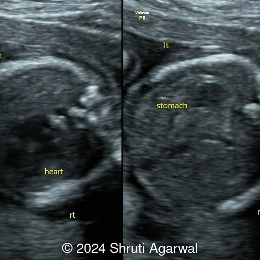 Case of the Week #608