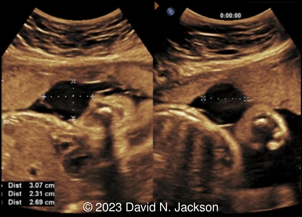 Case of the Week #583