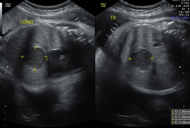 Case of the Week #540