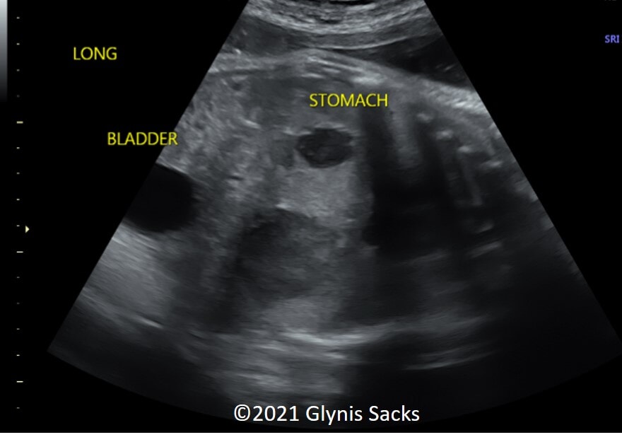 Case of the Week #540