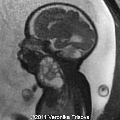 Case of the Week # 310