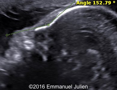 📃 Binder phenotype