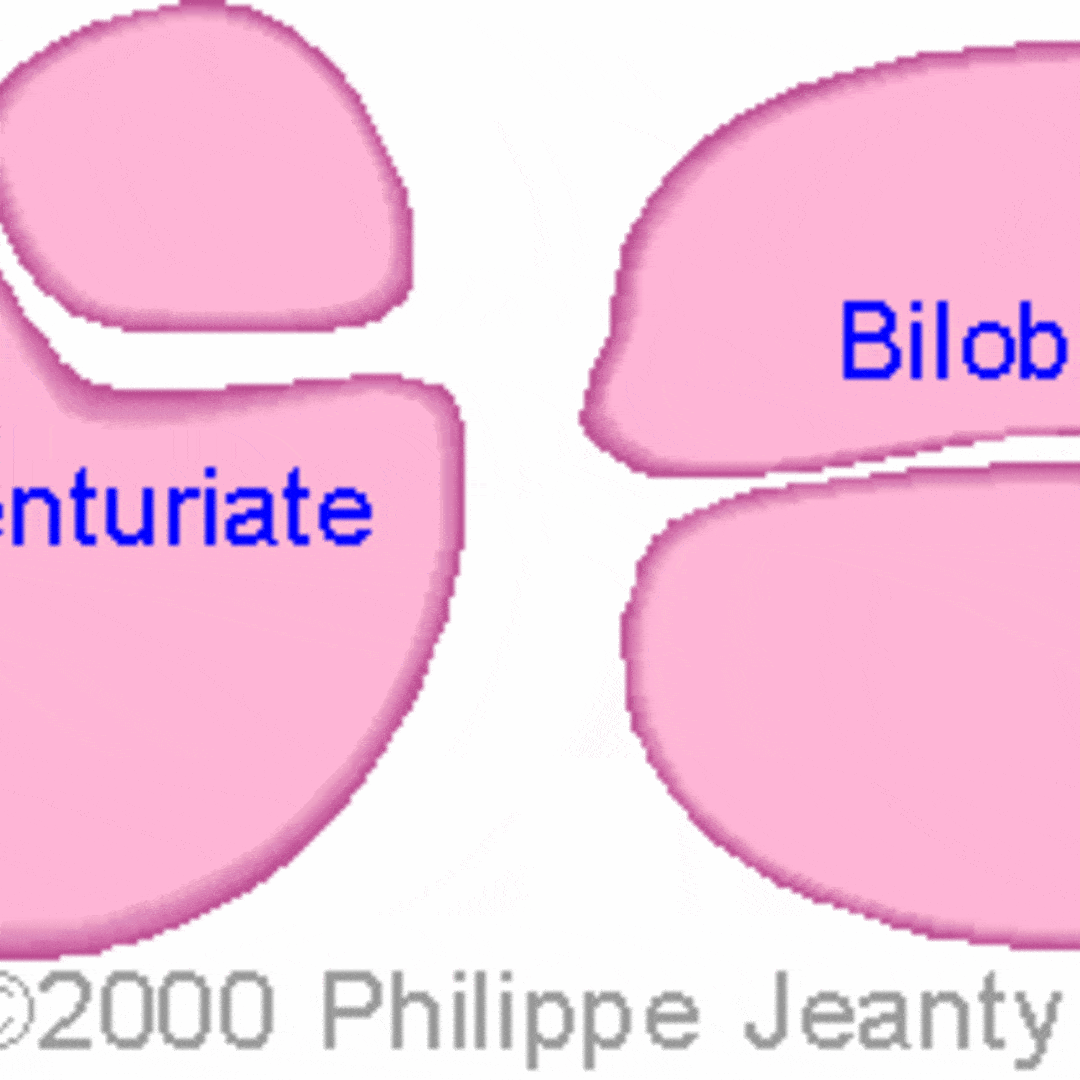 📃 Succenturiate & bilobate placenta